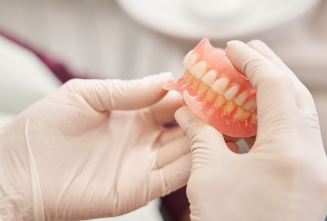 5 Common Myths About Dentures – Busted!